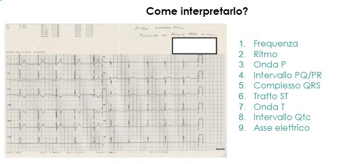 Come leggere l'ECG: un metodo per imparare l'elettrocardiogramma