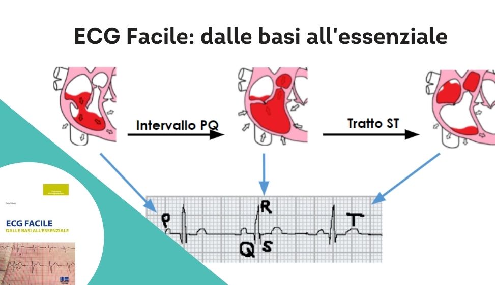 "ECG Facile" il manuale per imparare a leggere l'elettrocardiogramma
