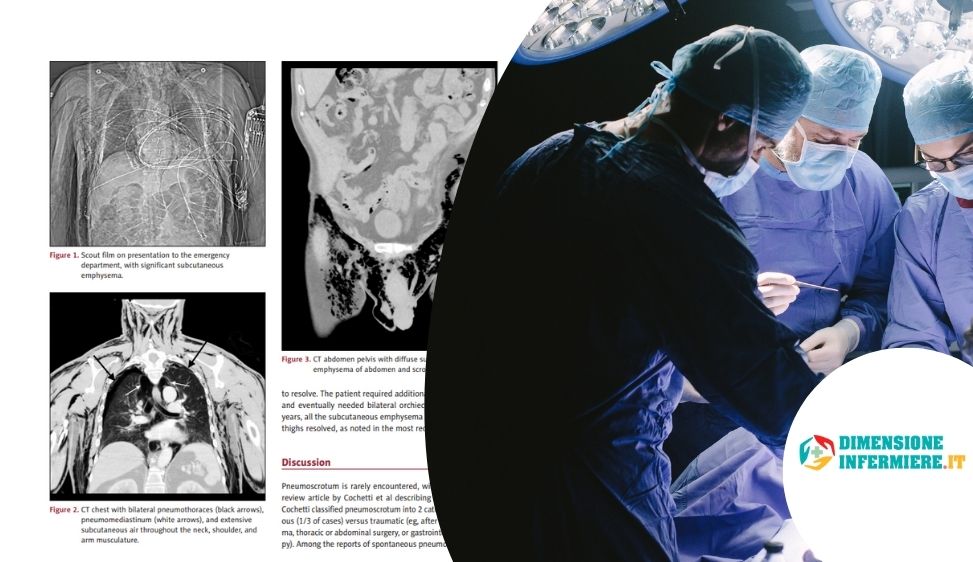 In ospedale per "scroto che fischia": un raro caso di pneumoscroto
