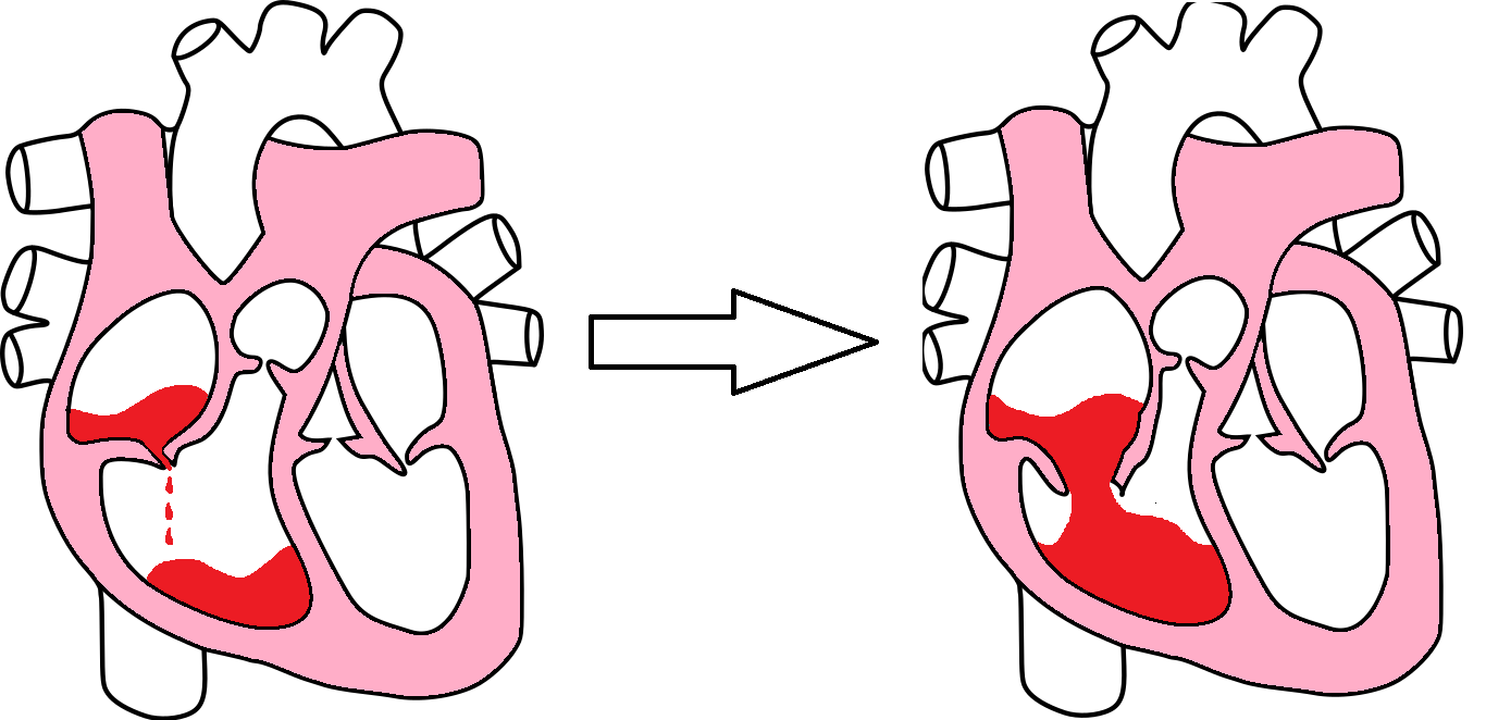 Ciclo cardiaco riassunto, completo e schematizzato con grafici