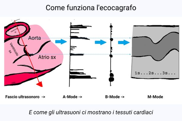 Imparare a interpretare un ecocardiogramma per migliorare l'assistenza infermieristica