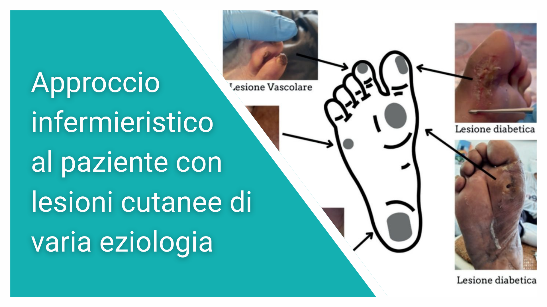 Approccio infermieristico al paziente con lesioni cutanee