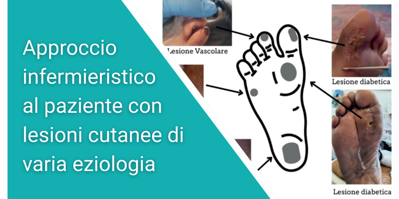 Stadiazione delle lesioni da pressione secondo NPIAP-EPUAP